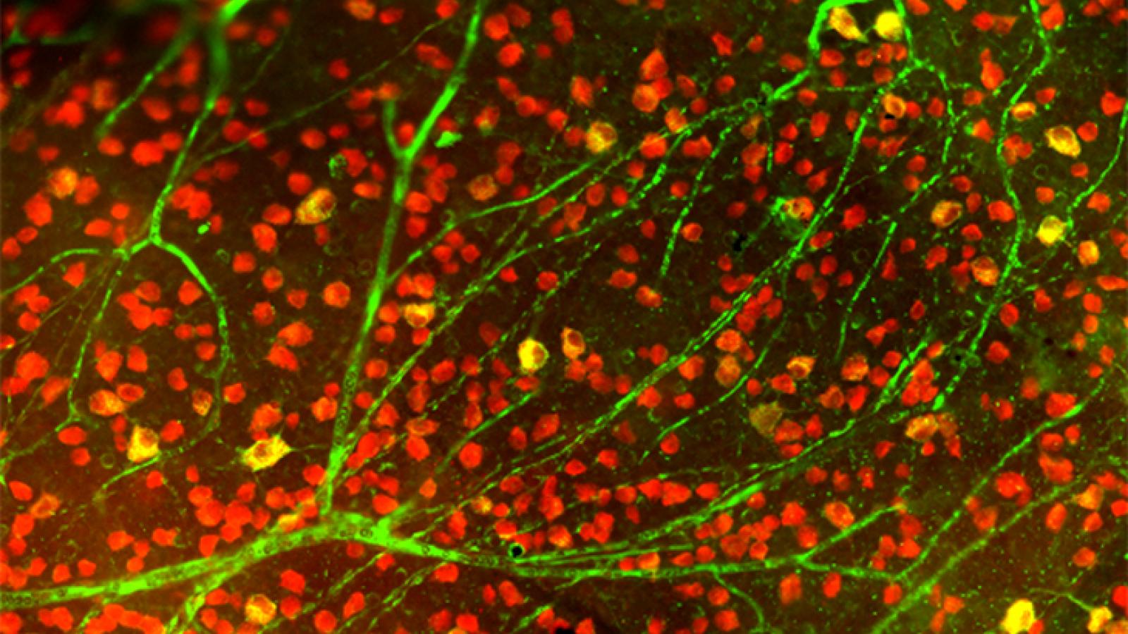 Singh Lab - University of Missouri School of Medicine